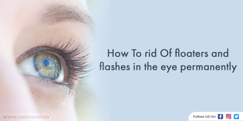 How To Rid Of Floaters And Flashes In The Eye Permanently