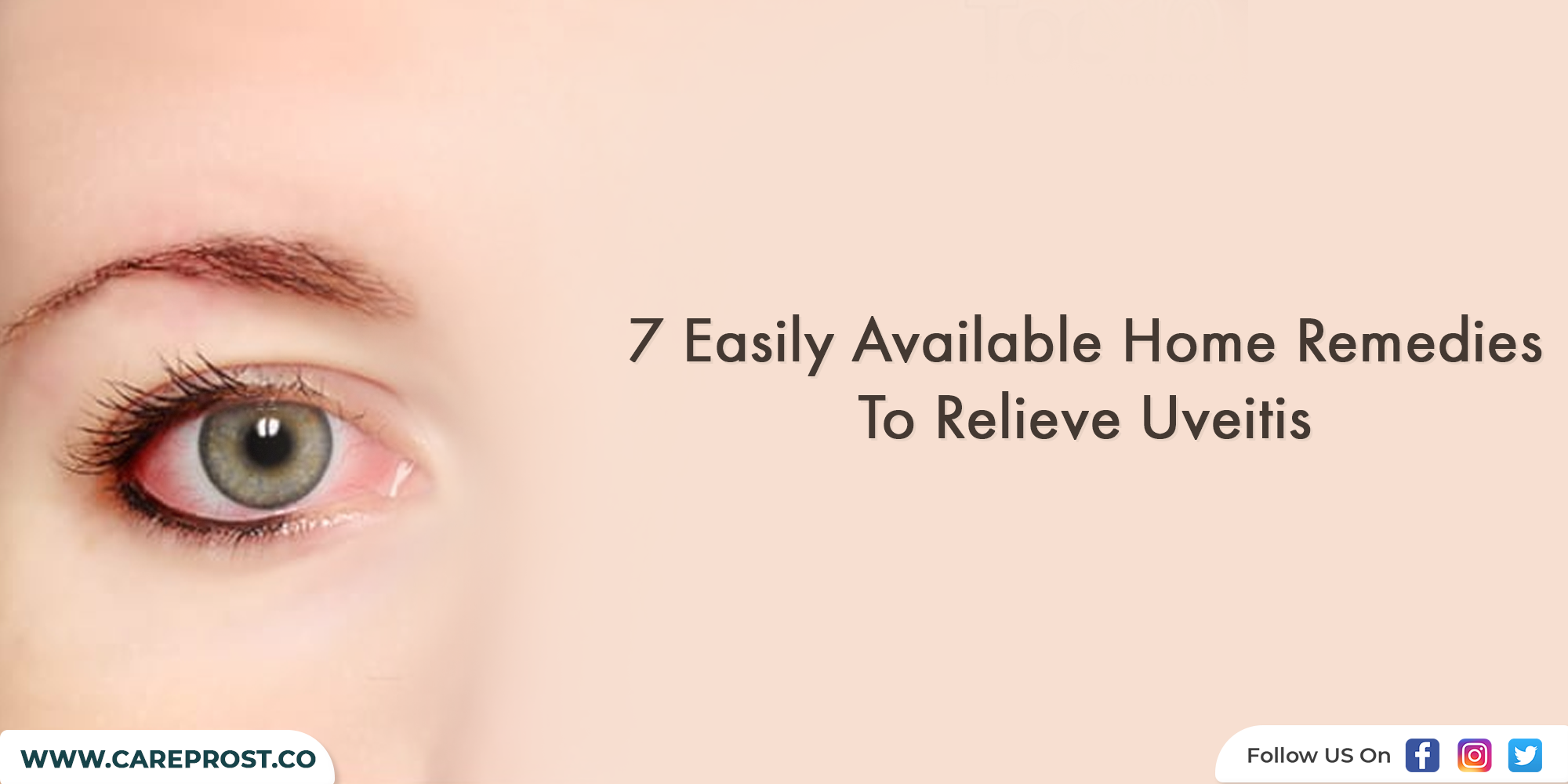 7 Easily Available Home Remedies To Relieve Uveitis