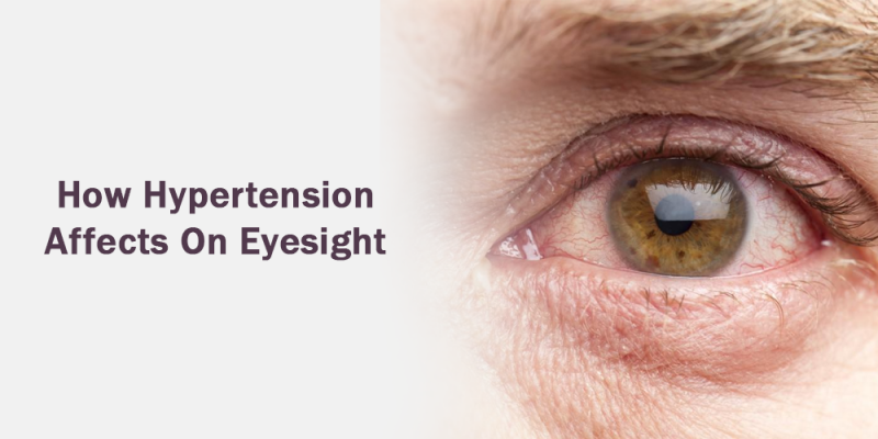 How Hypertension Affects on Eyesight