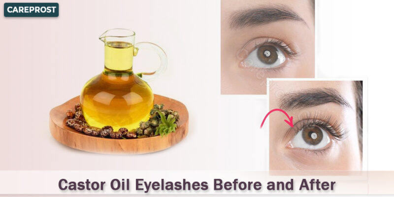 Castor Oil Eyelashes Before and After: Unveiling the Secrets of Natural ...